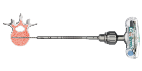 SpineGuard, Real Time Sensing DSG Technology, PediGuard, Spine