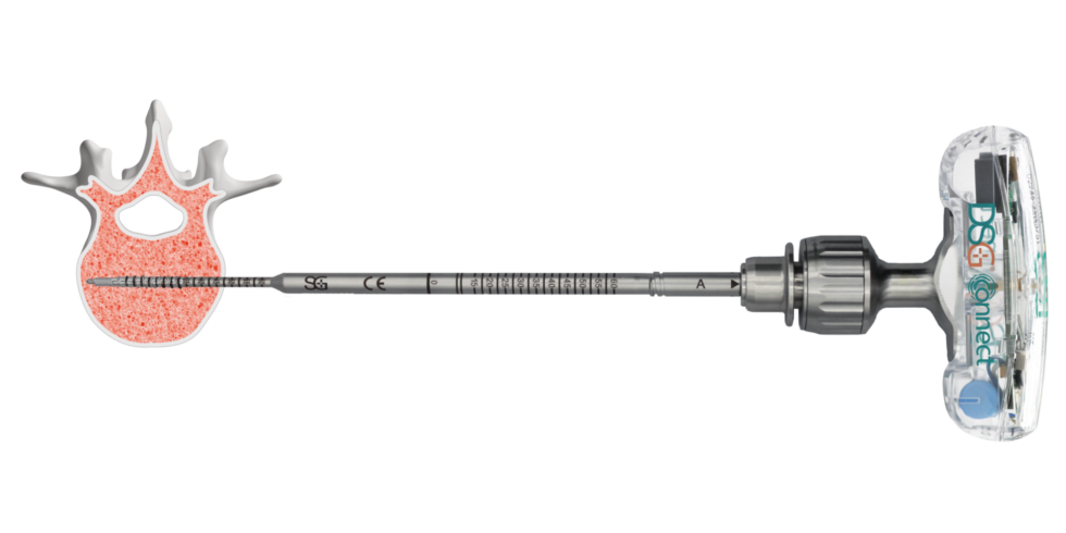 SpineGuard, Real Time Sensing DSG Technology, PediGuard, Spine