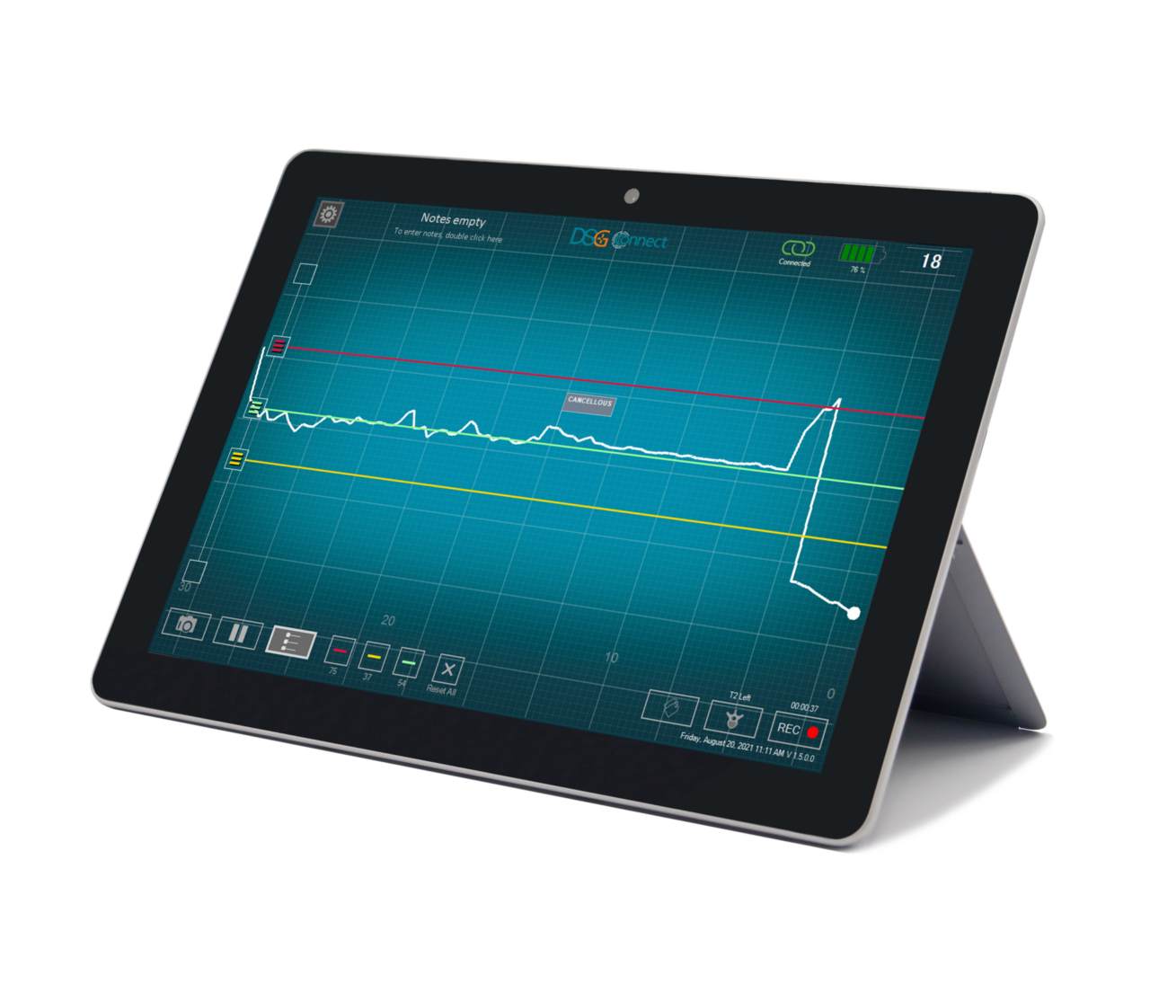 SpineGuard | User Manuals