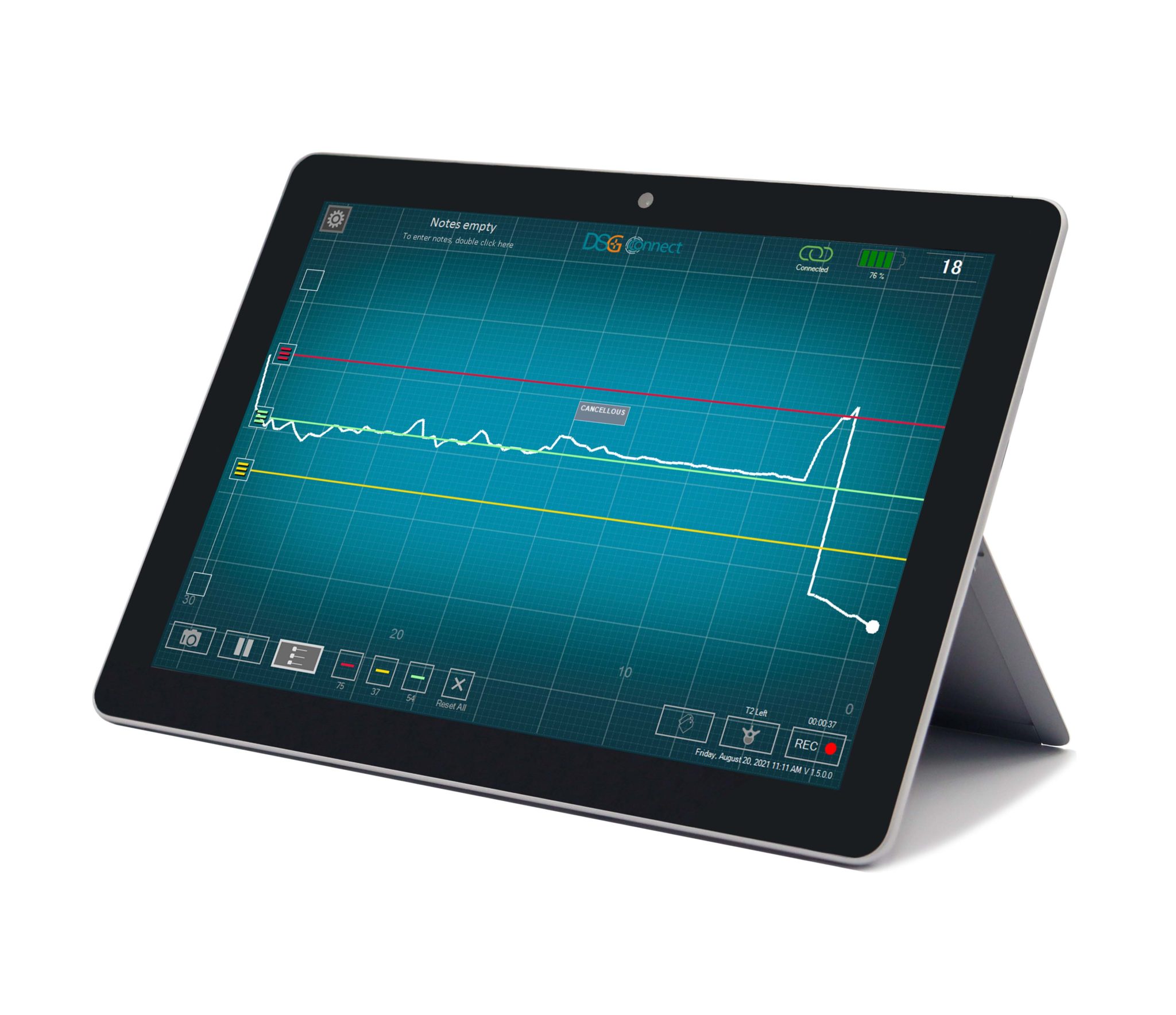 SpineGuard | Spine products