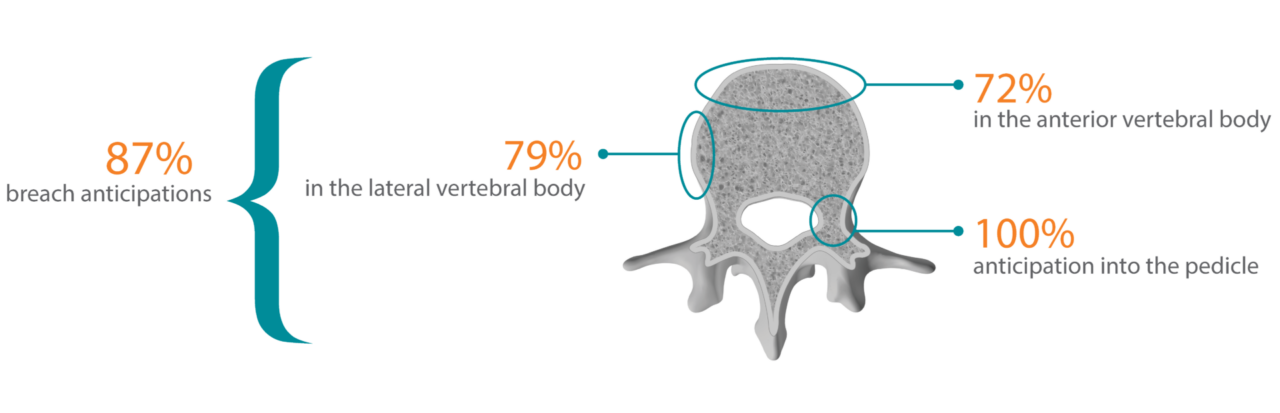 SpineGuard | Screw Placement Accuracy